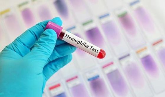 Kunnen vrouwen hemofilie hebben? | gezondheid.be