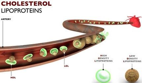 Wat kunt u doen bij familiale hypercholesterolemie? | gezondheid.be