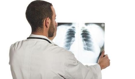 Chronisch obstructief longlijden (COPD) verhoogt het risico op een ...