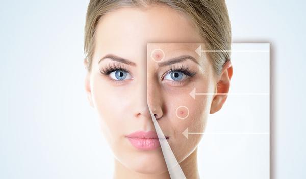 Wat is jouw huidtype en wat is daarvoor de gepaste gezichtsverzorging ...