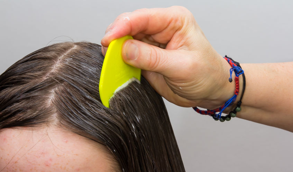 Hoofdluizen behandelen: hoe werkt de nat-kam-methode? | gezondheid.be