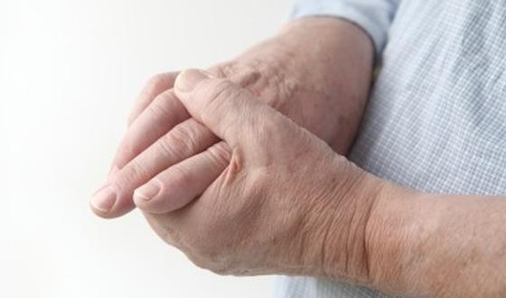 Jicht: is voeding de oorzaak en helpt een dieet? | gezondheid.be