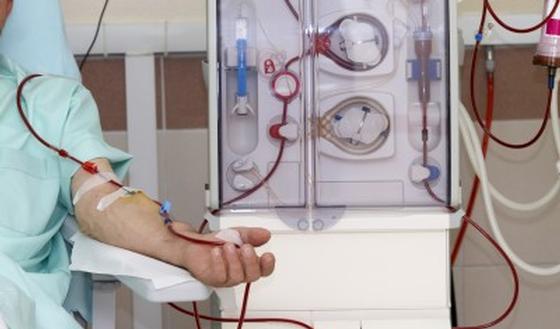 Hoe gaat nierdialyse in zijn werk? | gezondheid.be
