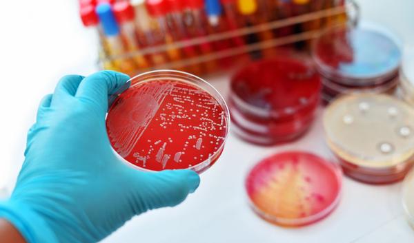 Dreigt er een comeback van difterie? | gezondheid.be