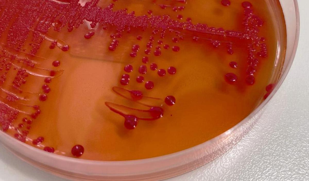 Hoe gevaarlijk is de STEC-bacterie? | gezondheid.be