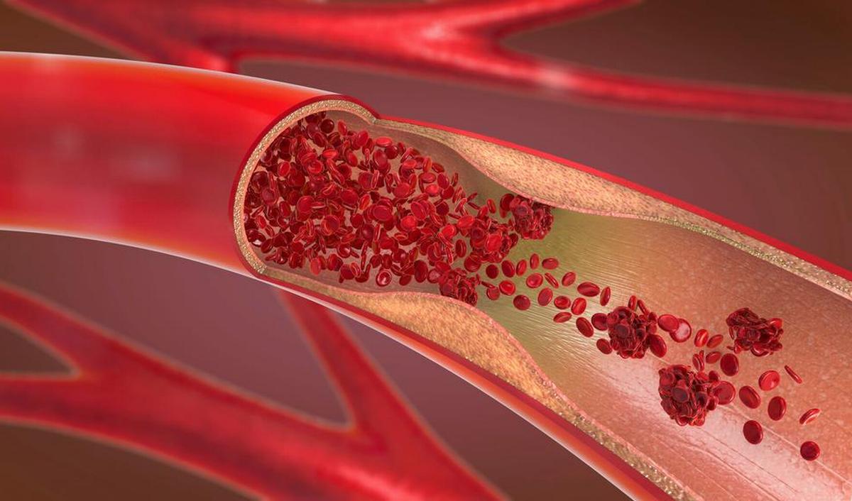 Wat is een coronarografie (coronaire angiografie)? | gezondheid.be