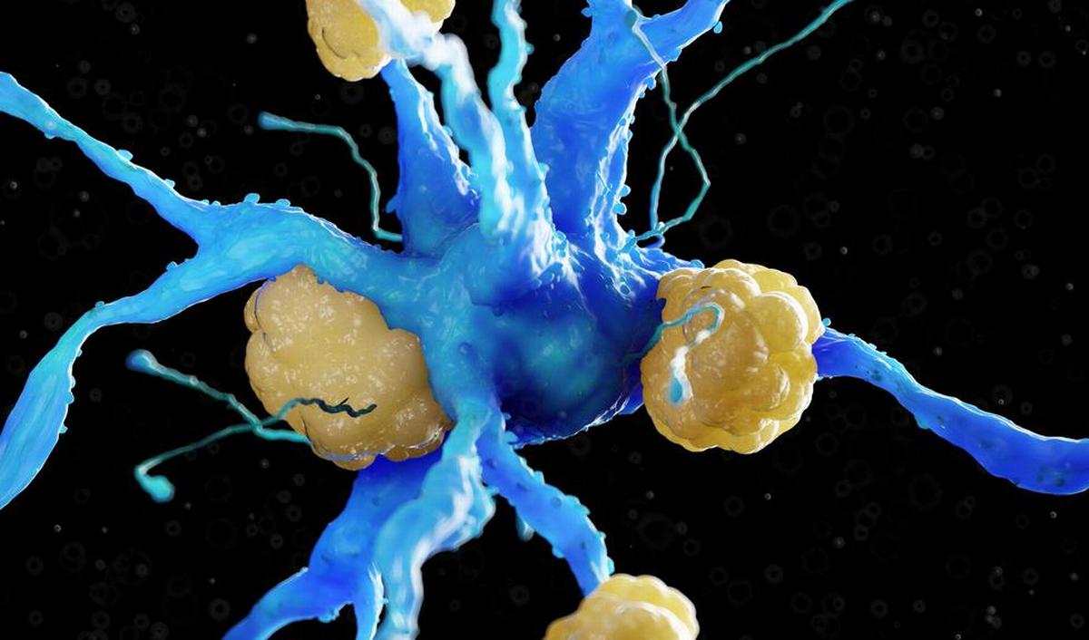 Amyloïdose: eiwitstapelingsziekte | gezondheid.be