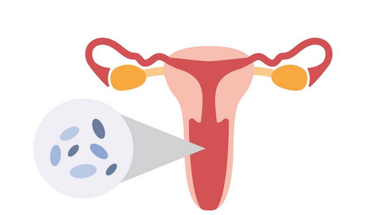 Bacteriële vaginose: symptomen en behandeling | gezondheid.be