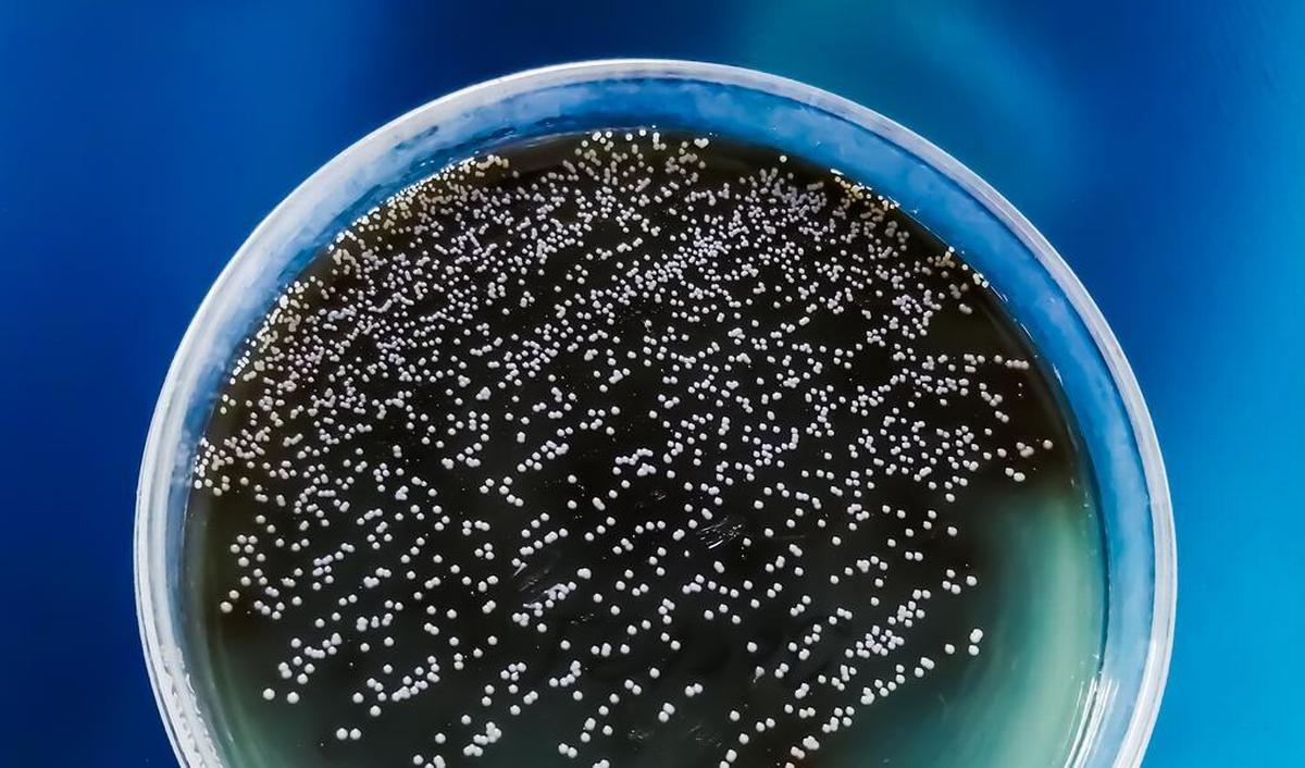 Candida-infectie (candidiasis) | gezondheid.be