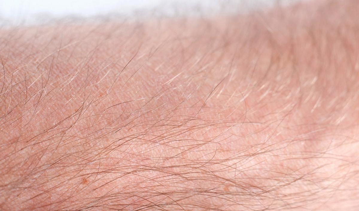 Ongewenste haargroei door geneesmiddelen | gezondheid.be