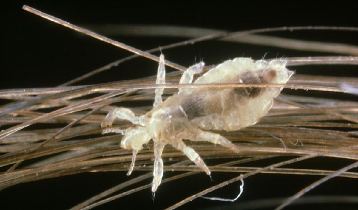 Wat voor beestjes zijn luizen? | gezondheid.be