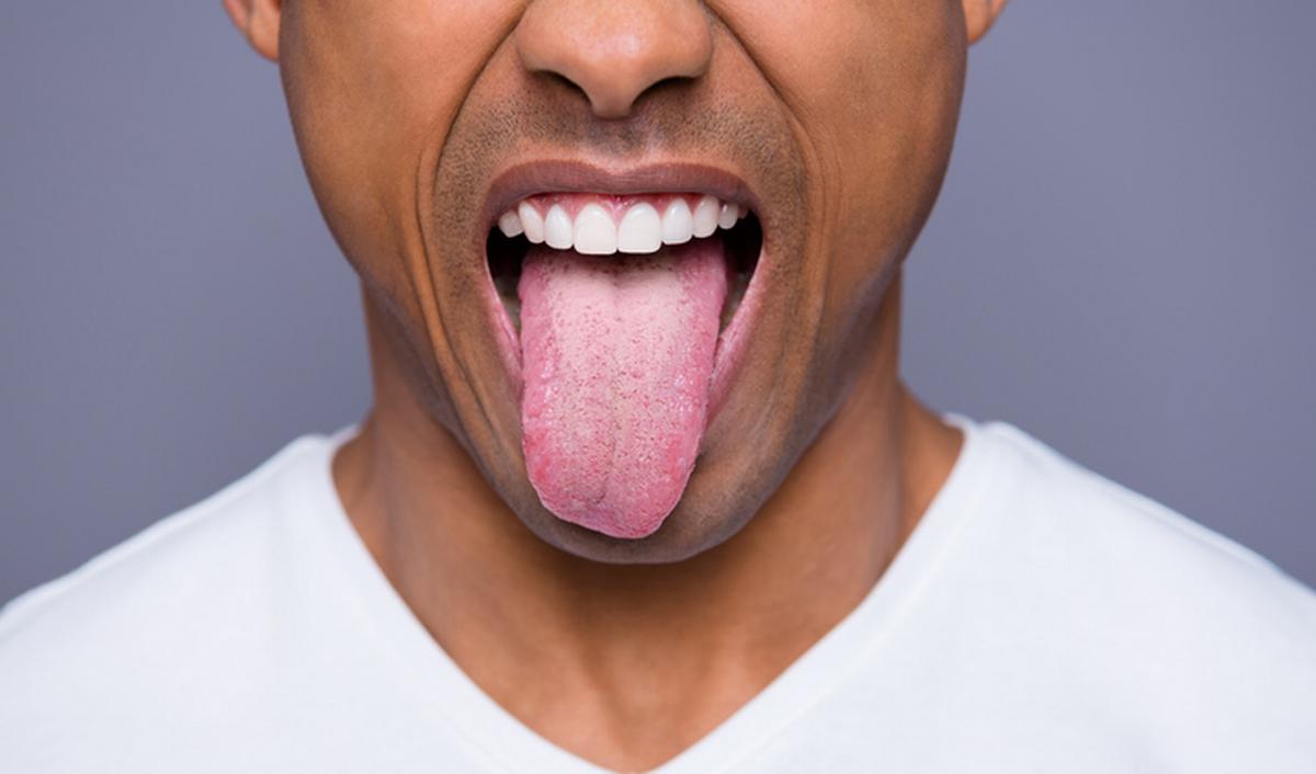 Wat zegt je tong over je gezondheid? | gezondheid.be