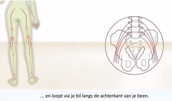 Video: Ischias | gezondheid.be